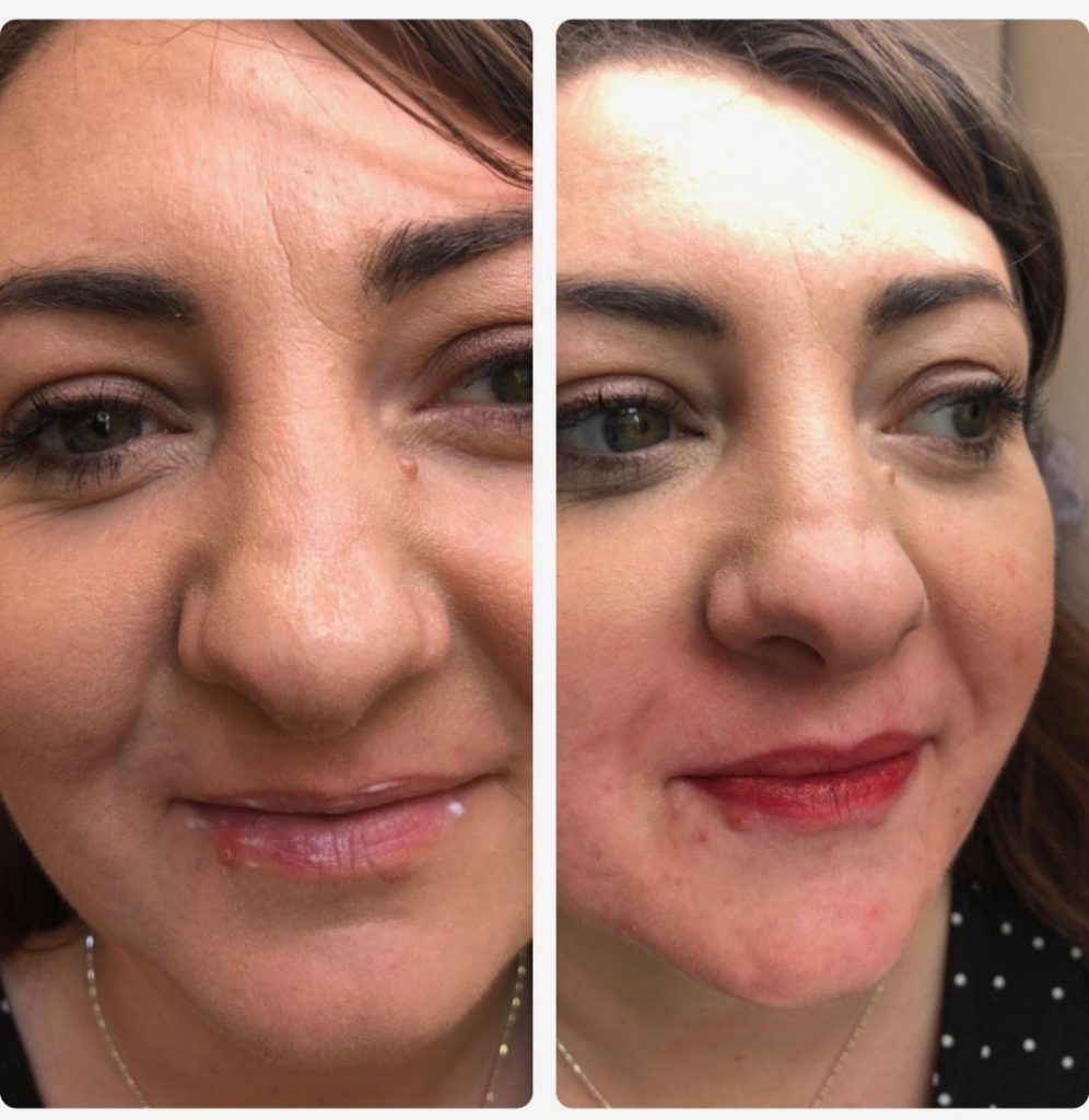 Check another happy new customer who had their semi permanent lip ...